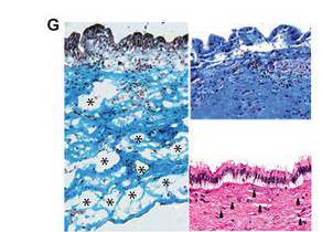 And then there were 80: The discovery of a new human organ – The ...